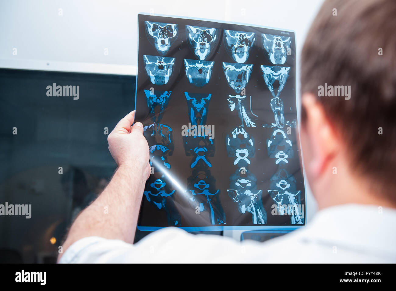 Mri scan head injury hi-res stock photography and images - Alamy