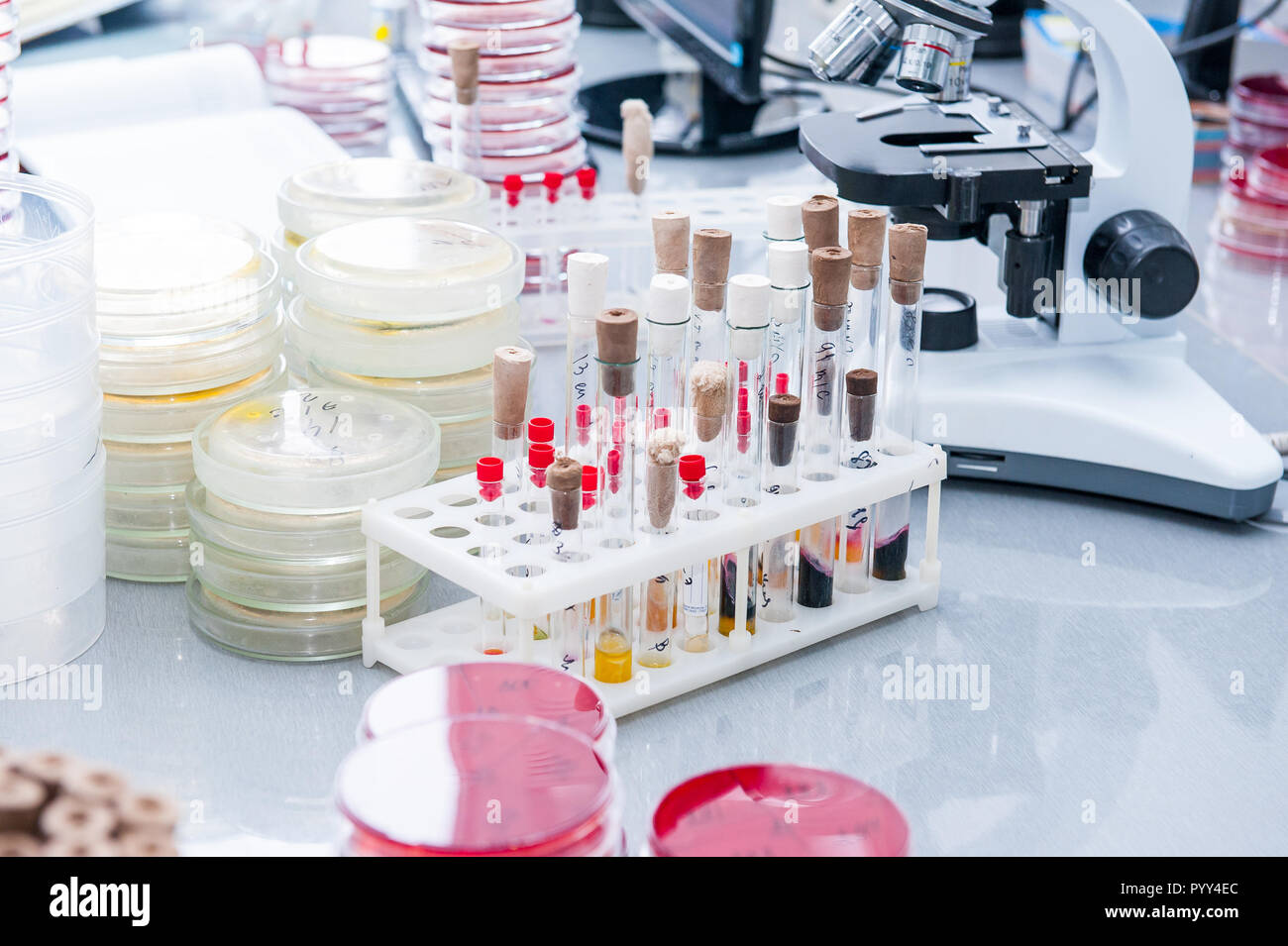 Details of microbiology laboratory; Petri dishes for bacteria growing ...