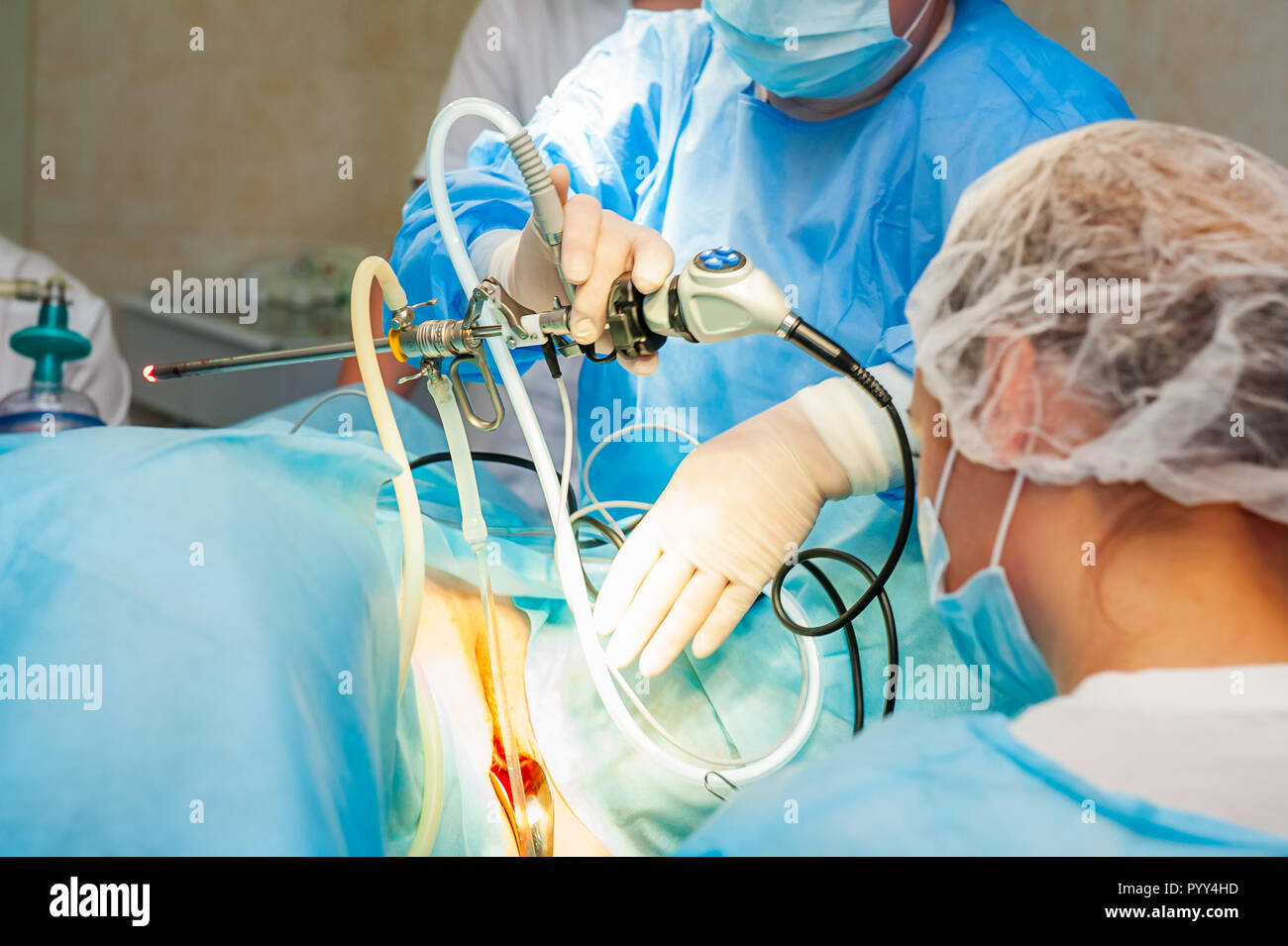 Process of Gynecological surgery operation using laparoscopic equipment ...