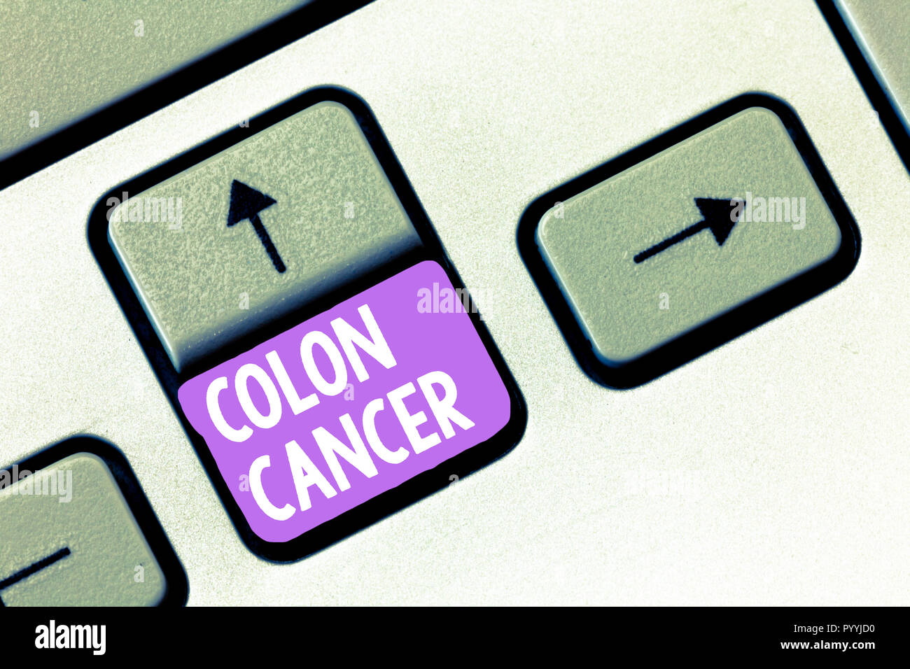 Handwriting text Colon Cancer. Concept meaning Cancer that forms in the ...