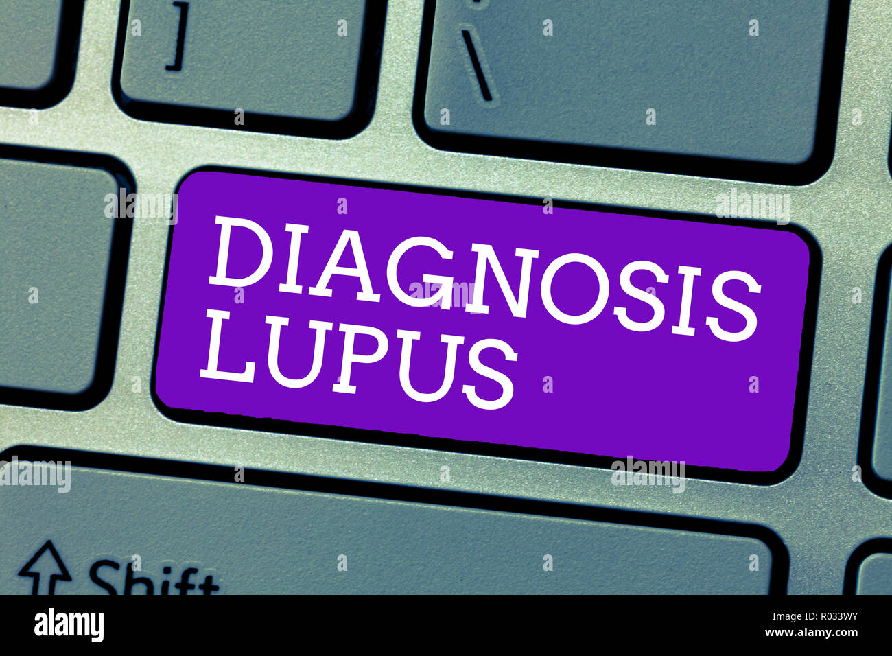 Word writing text Diagnosis Lupus. Business concept for Urine examination show an increase of ...
