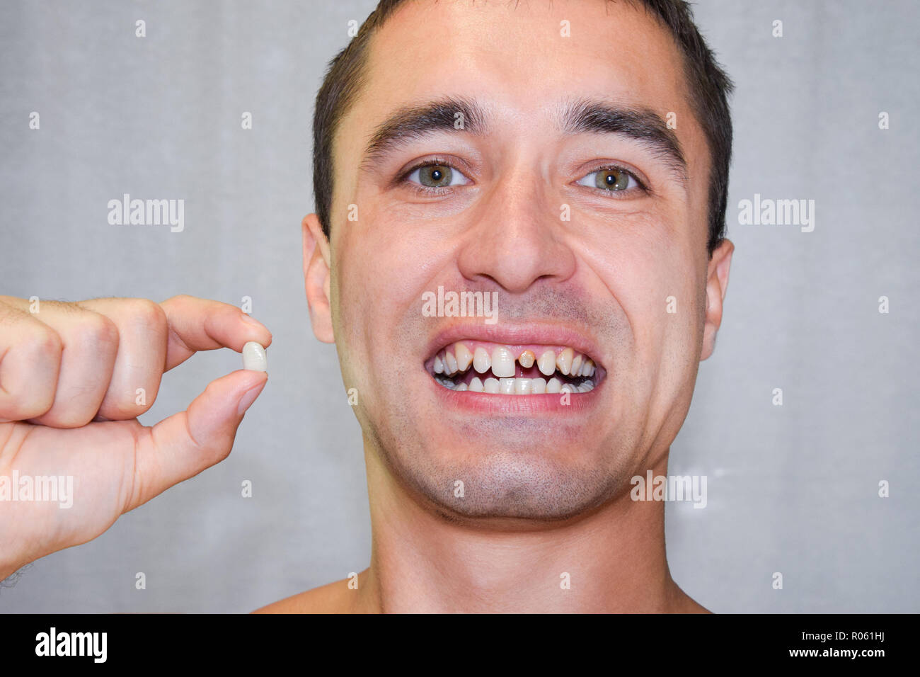 Dental prosthesis of metal ceramics in the hand of a man without a ...