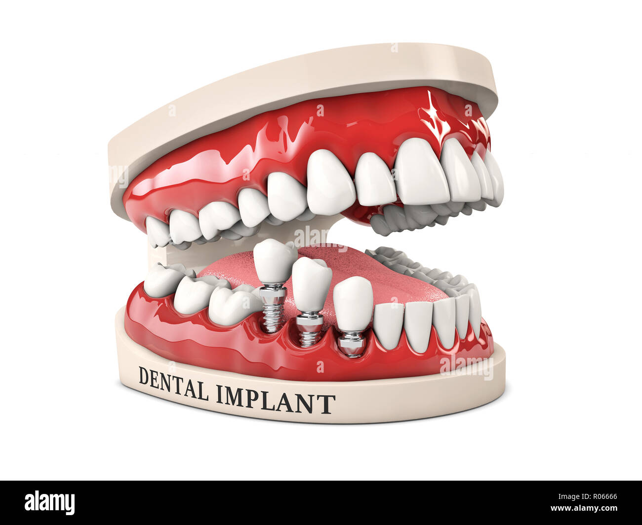 Human technology implant artificial Cut Out Stock Images & Pictures - Alamy