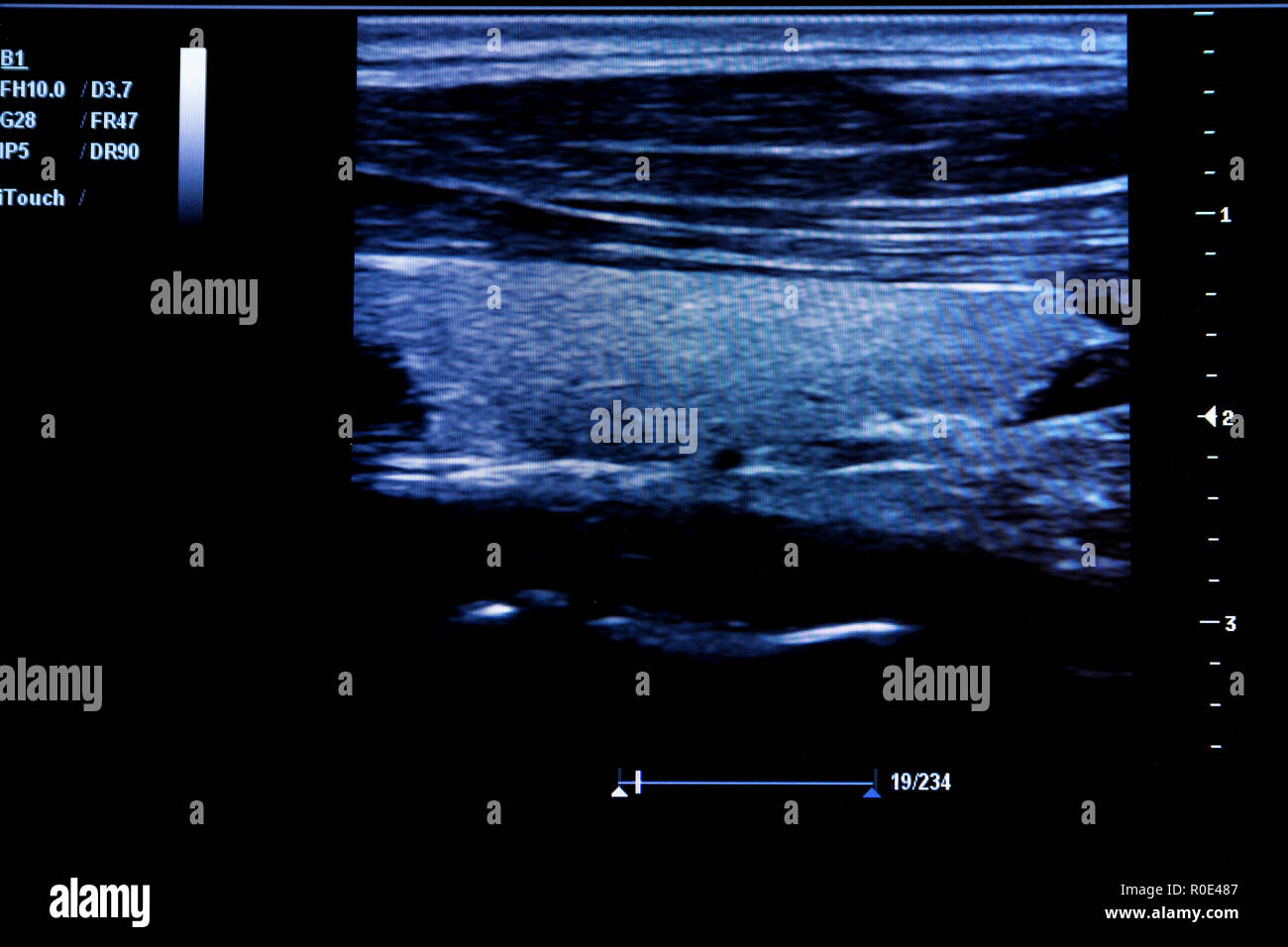 Colourful image of modern ultrasound monitor. Ultrasonography machine ...