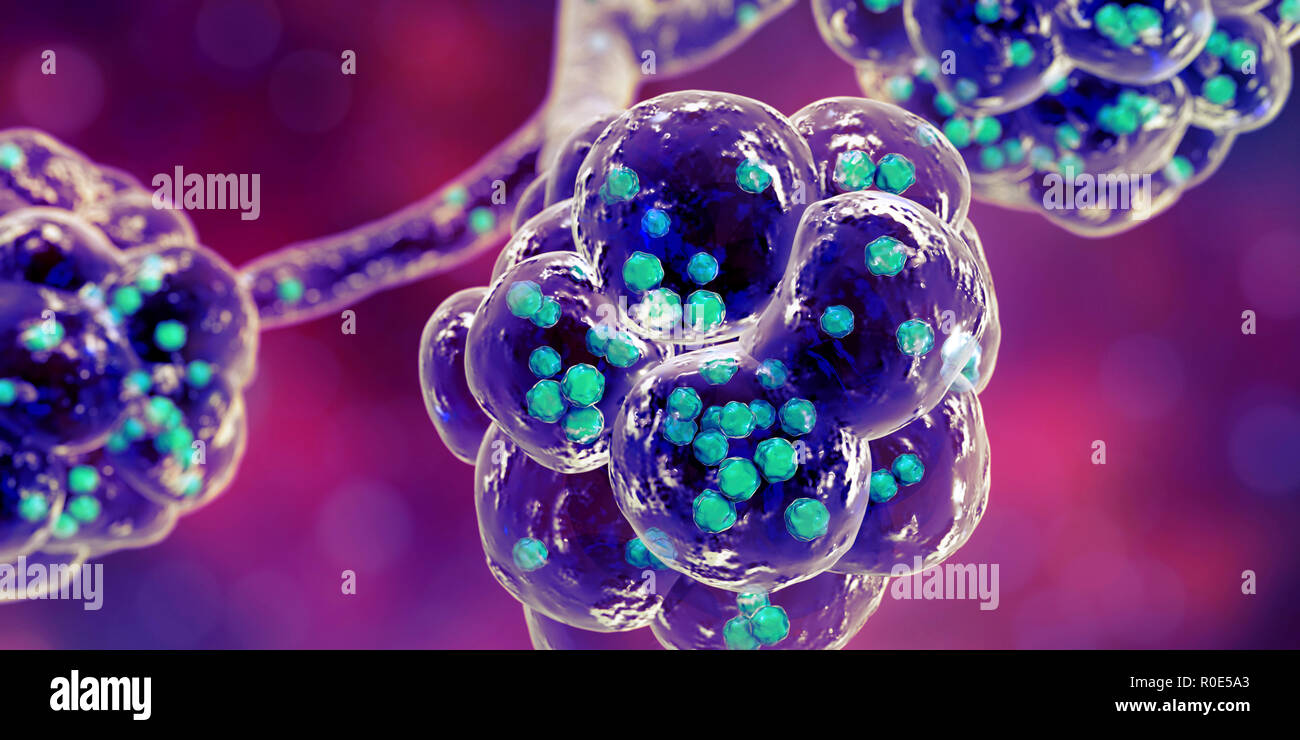 Staphylococcal infection hi-res stock photography and images - Alamy