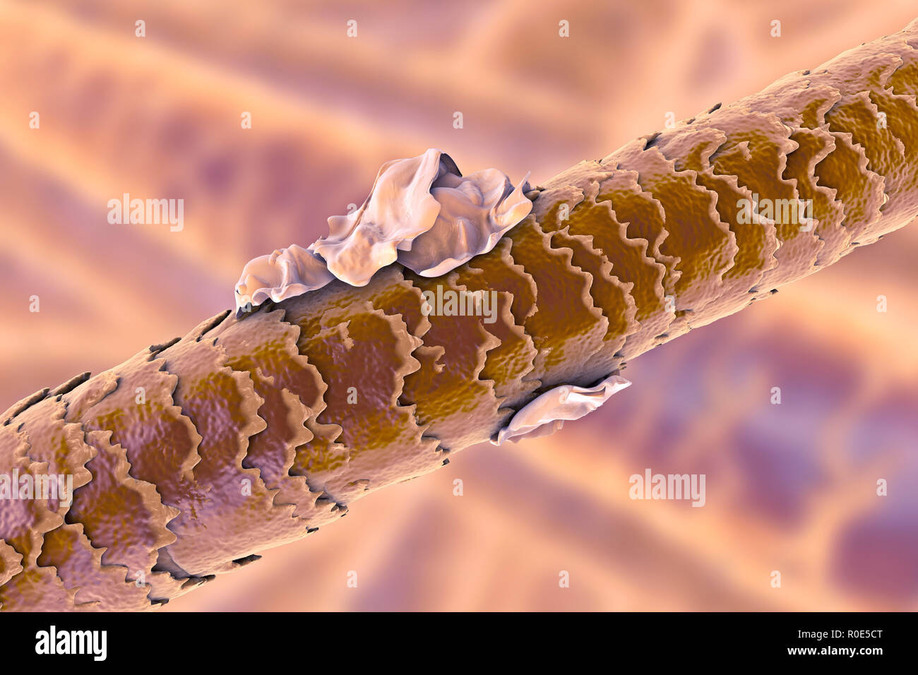 Human hair with dandruff, computer illustration Stock Photo - Alamy
