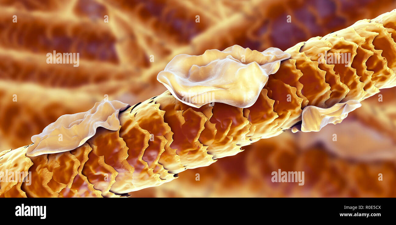 Human hair with dandruff, computer illustration Stock Photo - Alamy