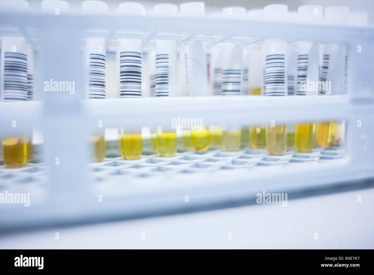 Medical samples in rack, close up Stock Photo - Alamy