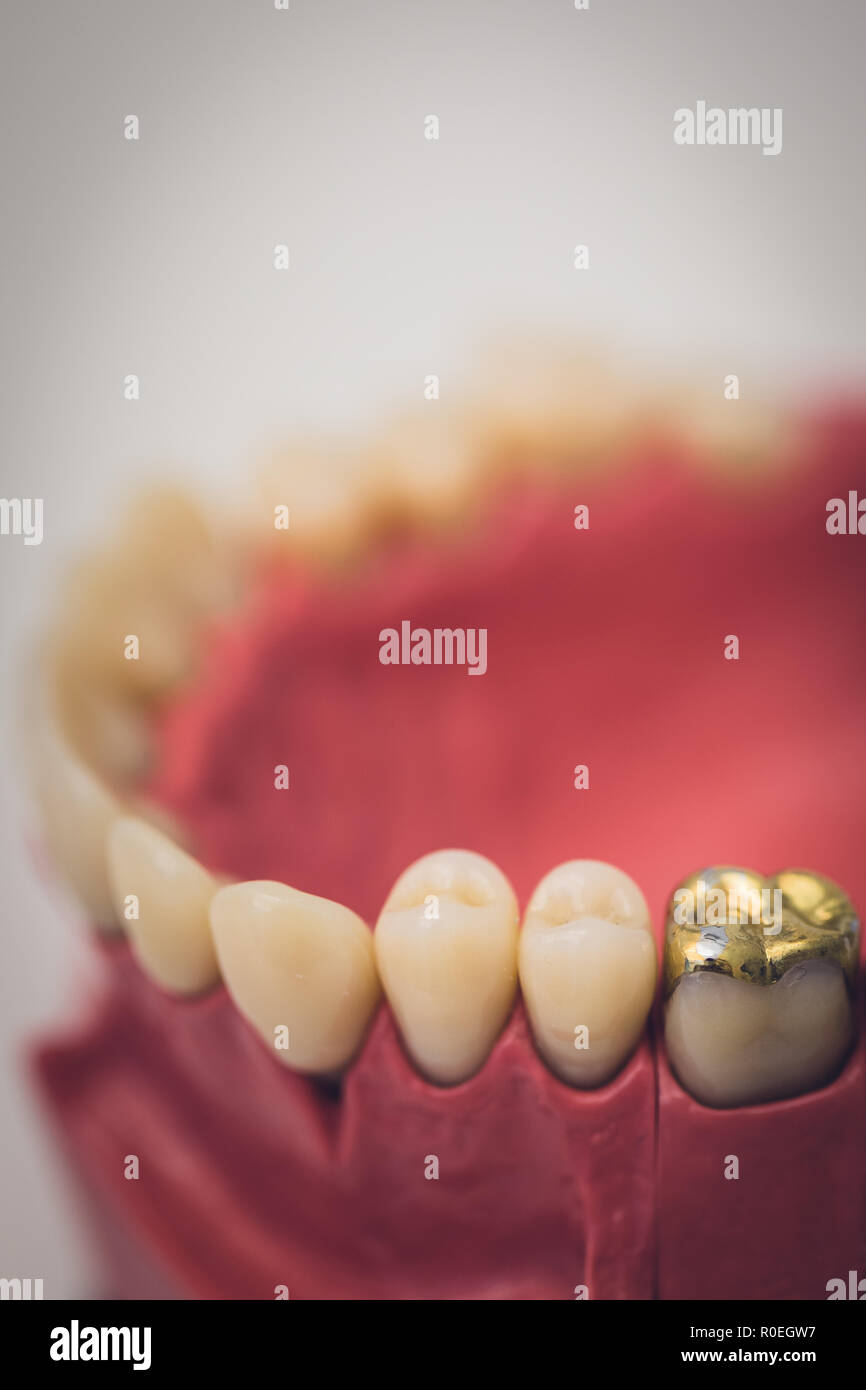 Detailed close up of dental denture or teeth on a table, dentistry ...