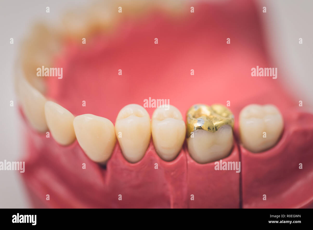 Detailed close up of dental denture or teeth on a table, dentistry ...