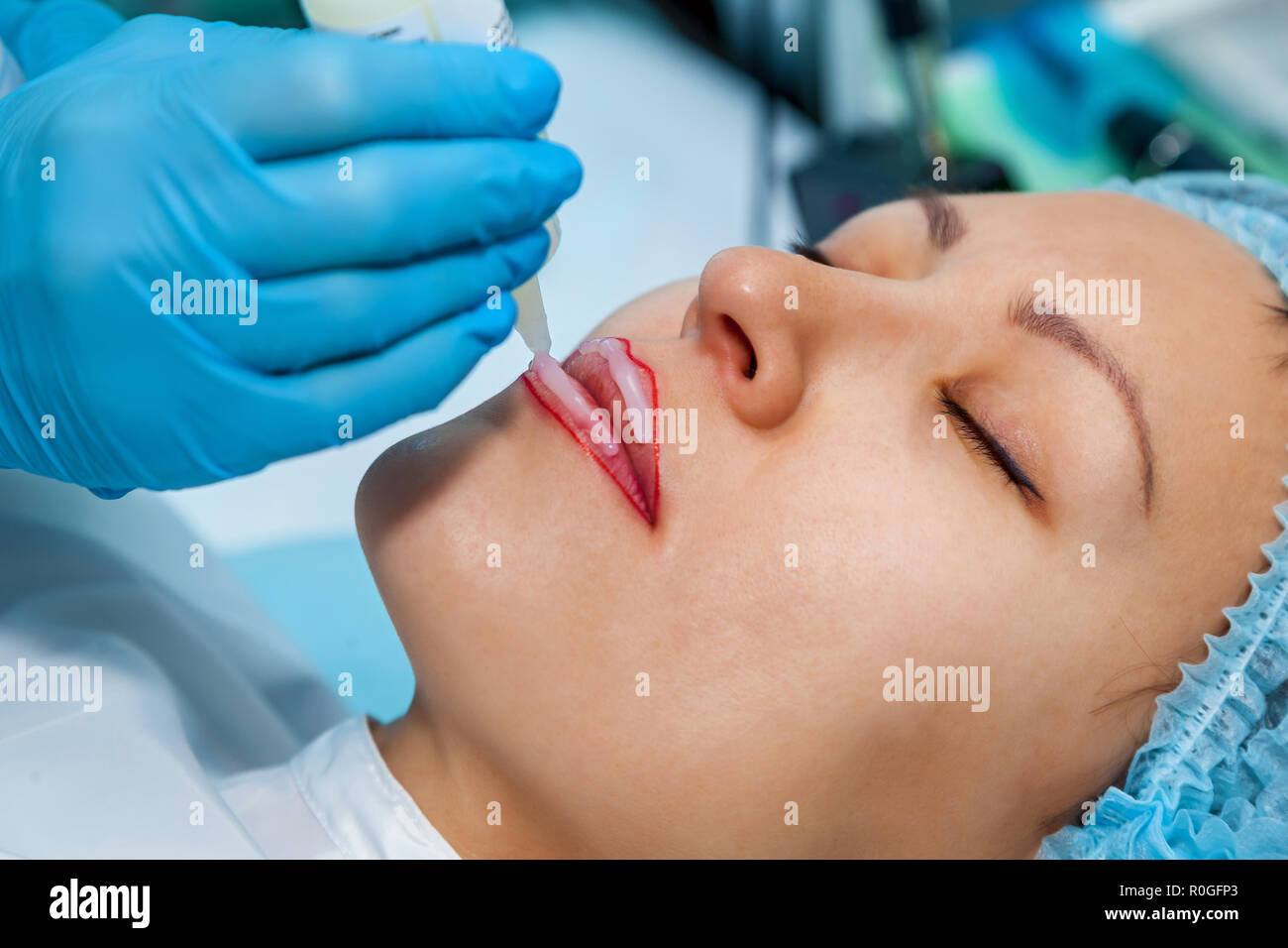 Beautician, anesthesia on the lips for permanent lip makeup. Lip tattoo ...