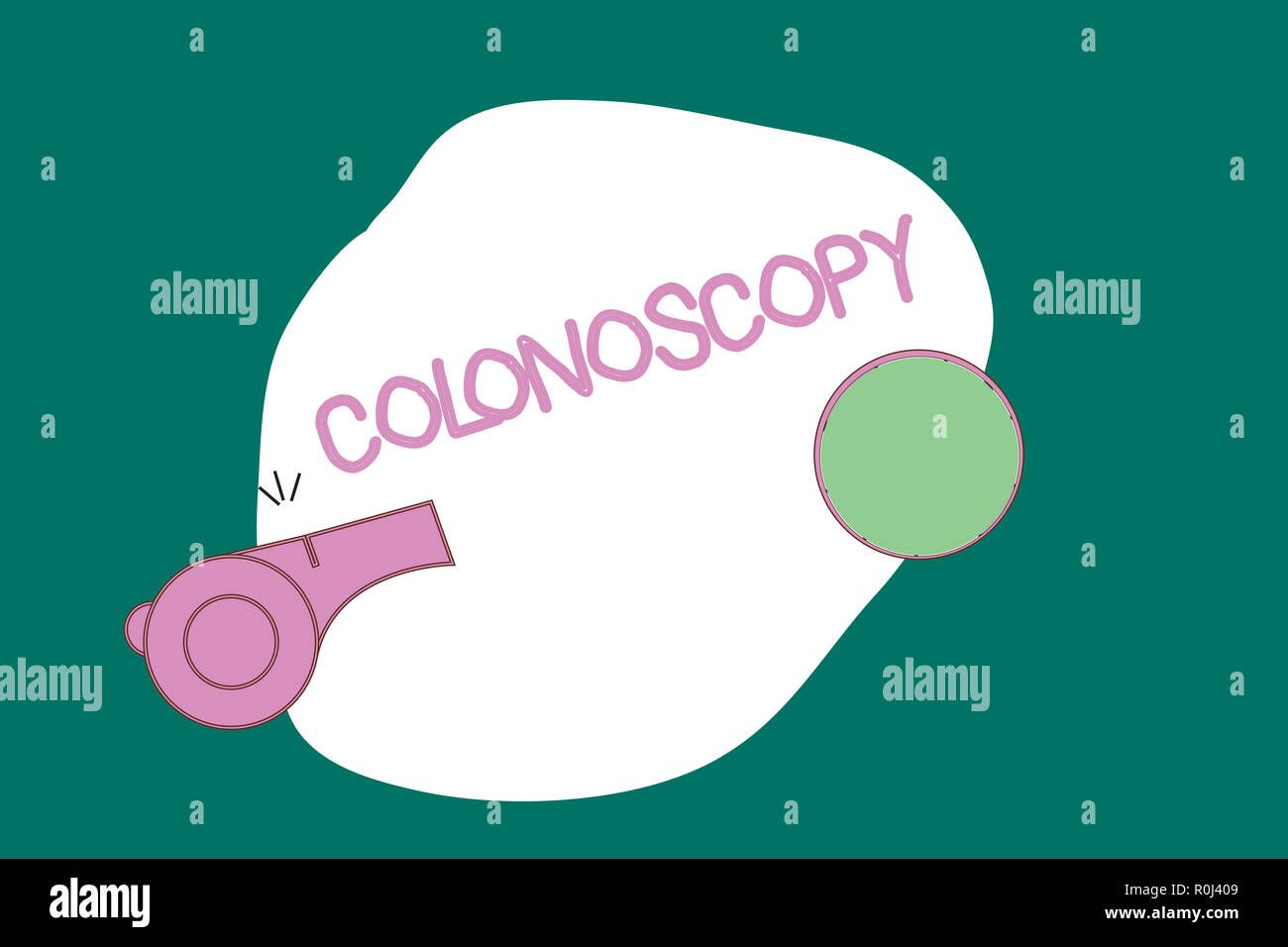 Writing note showing Colonoscopy. Business photo showcasing Endoscopic ...