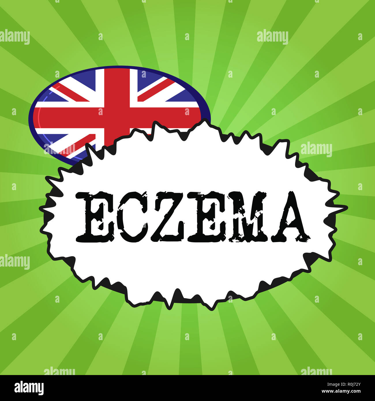 Handwriting text writing Eczema. Concept meaning Skin condition marked ...