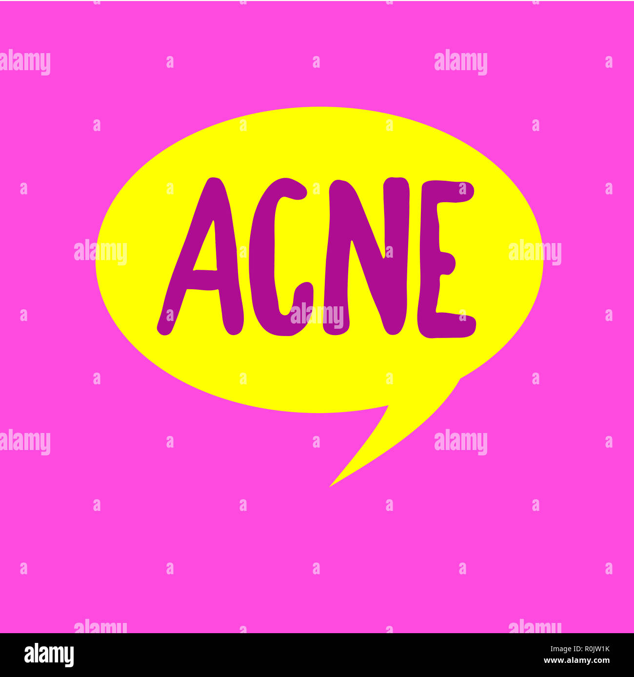 Writing note showing Acne. Business photo showcasing Skin disease ...