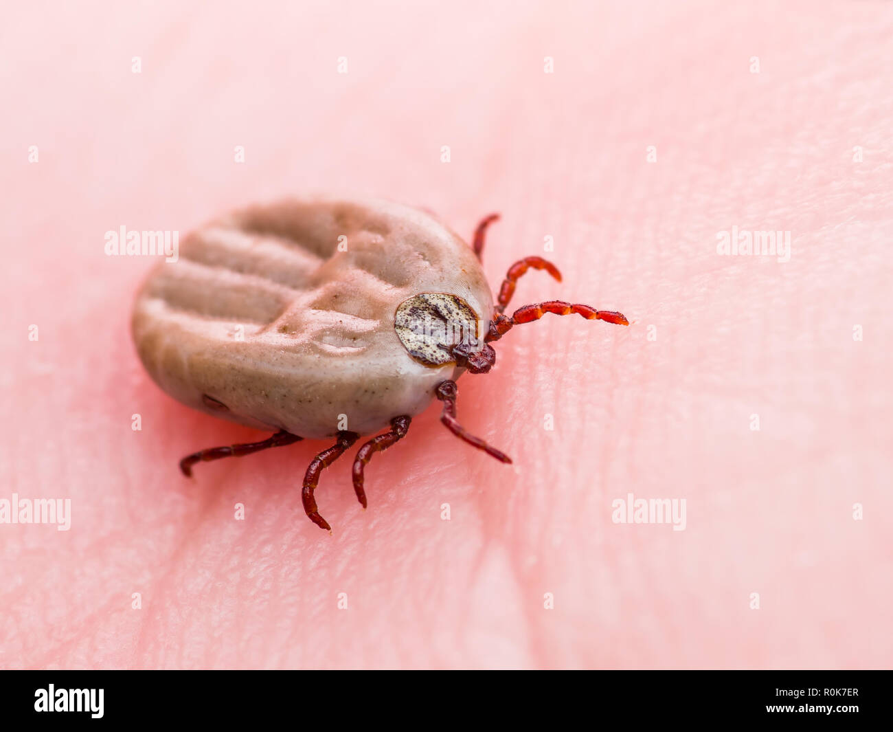 Encephalitis Virus or Lyme Disease or Monkey Fever Infected Tick ...