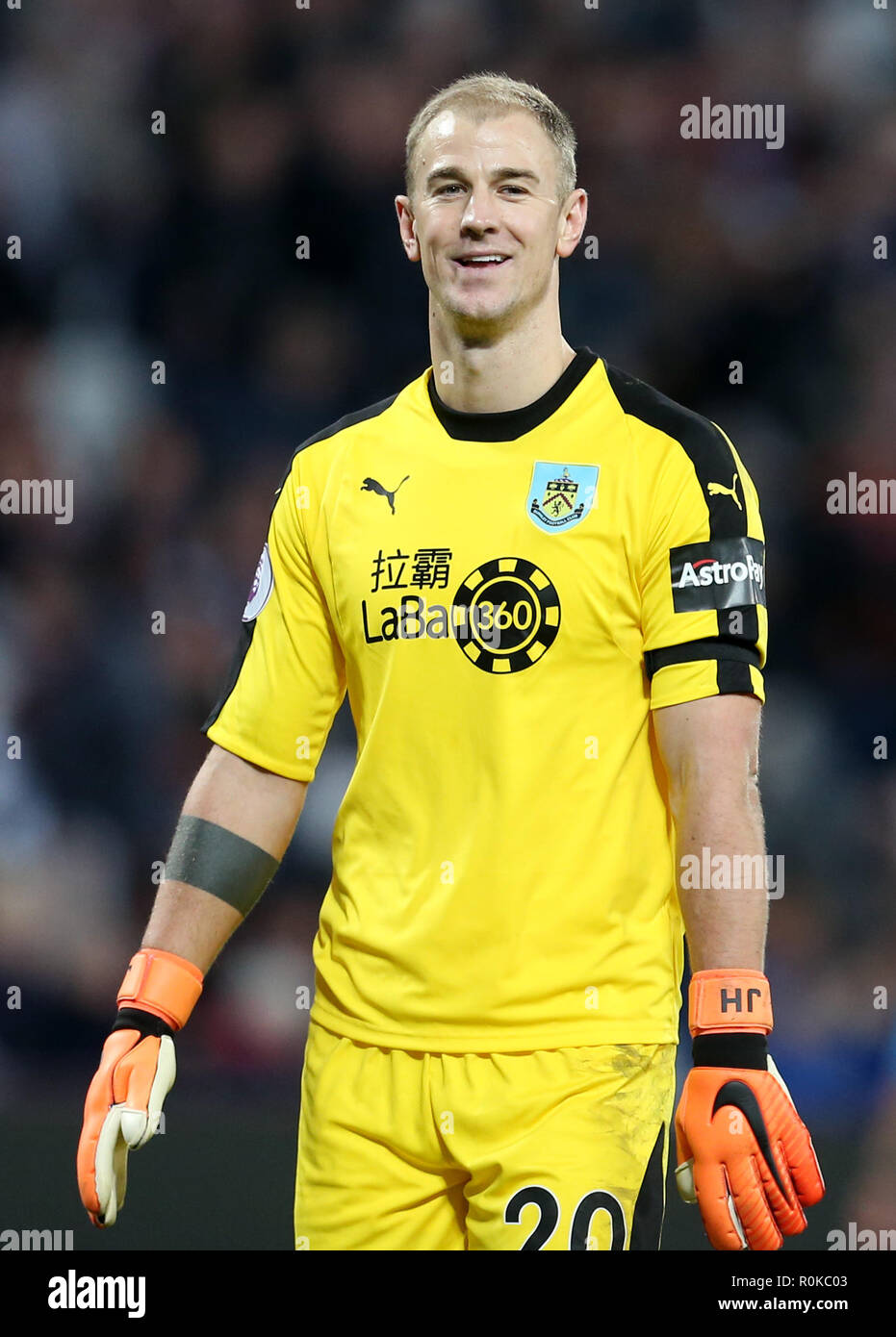Burnley goalkeeper Joe Hart Stock Photo - Alamy