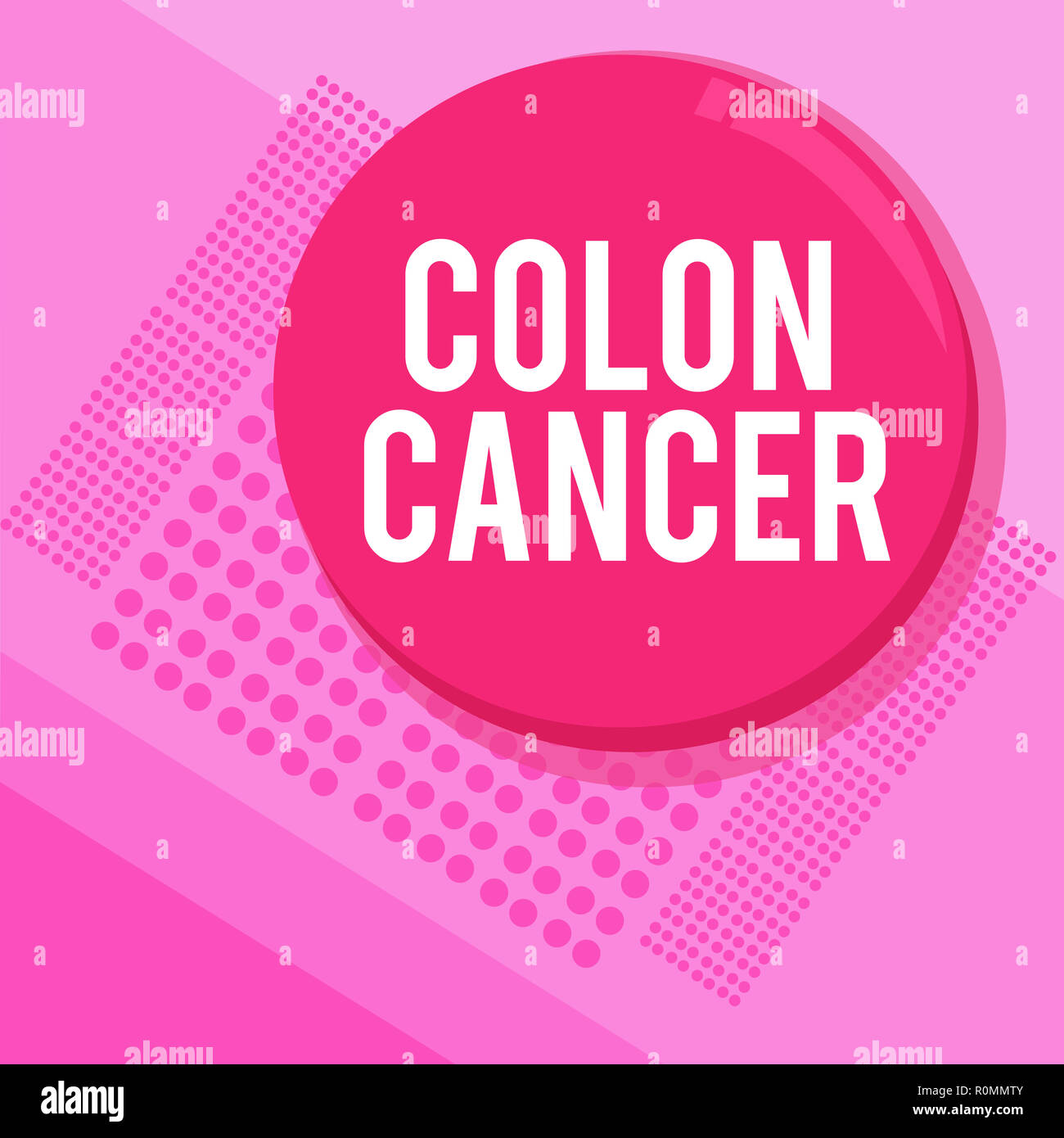 Word writing text Colon Cancer. Business concept for Cancer that forms ...