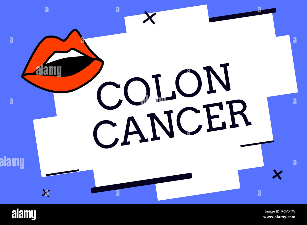 Writing note showing Colon Cancer. Business photo showcasing Cancer ...