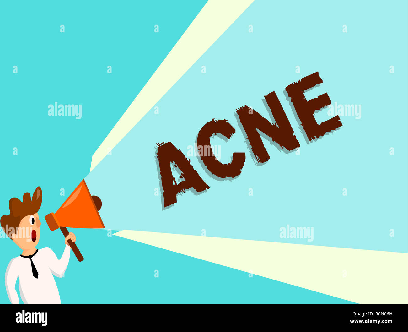 Conceptual hand writing showing Acne. Business photo text Skin disease ...