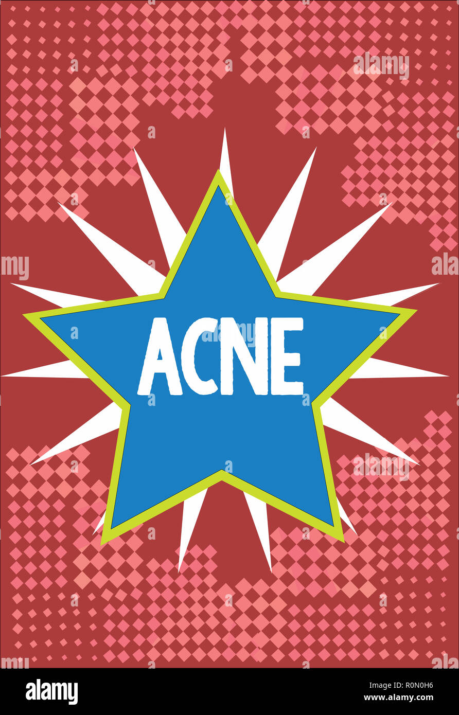 Word writing text Acne. Business concept for Skin disease involving the ...