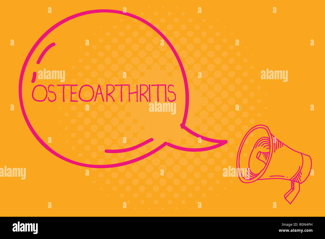 Conceptual hand writing showing Osteoarthritis. Business photo text ...