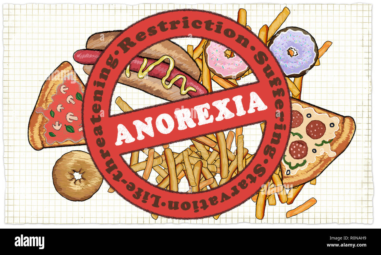 Anorexia nervosa hi-res stock photography and images - Alamy
