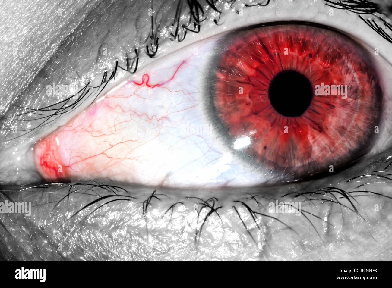 Human eye expressing surprise and fear macro close-up texture ...