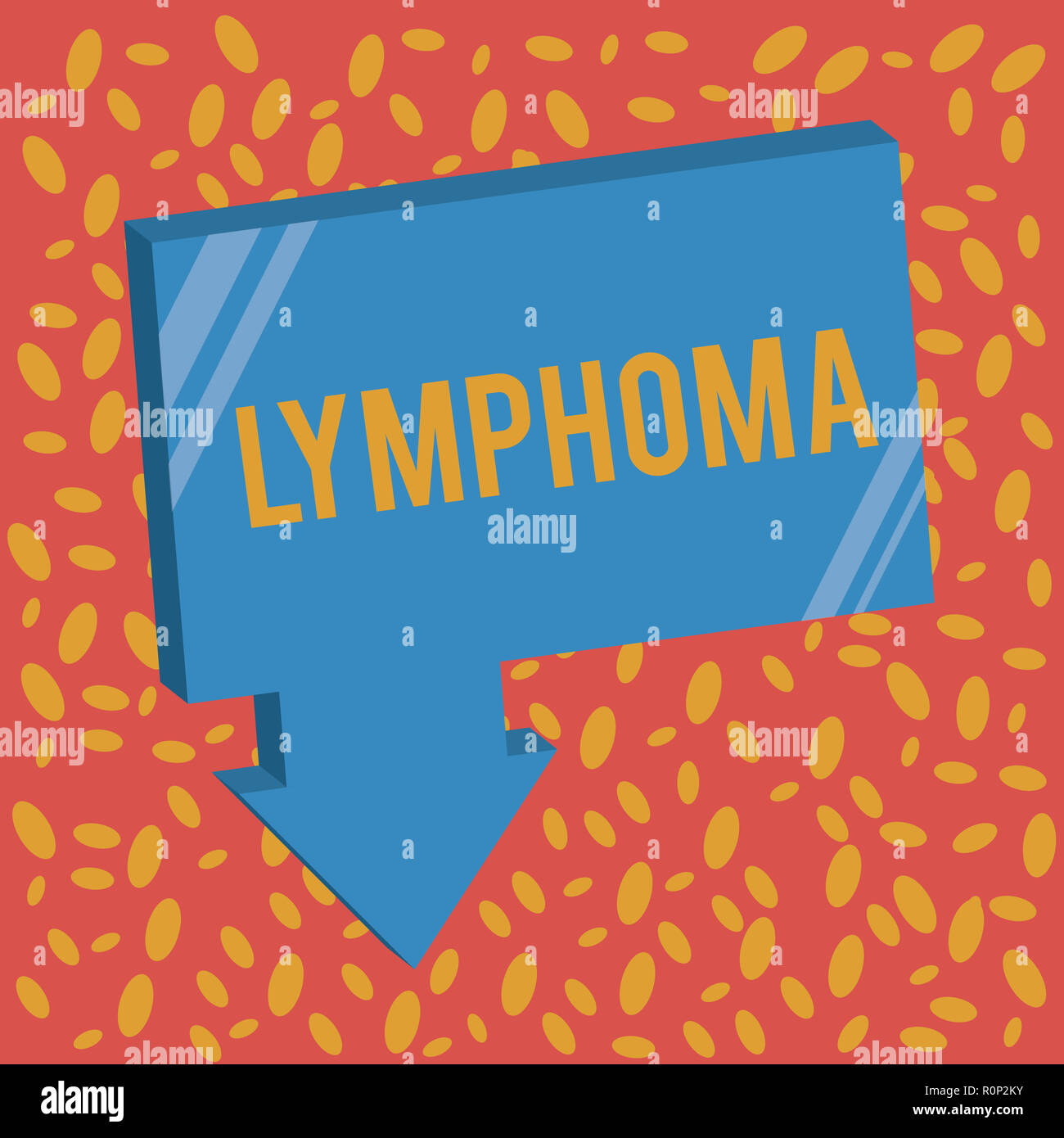 Writing note showing Lymphoma. Business photo showcasing Cancer that ...