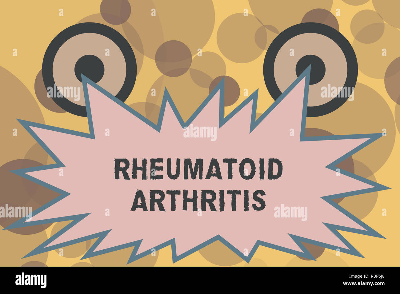 Text sign showing Rheumatoid Arthritis. Conceptual photo autoimmune ...