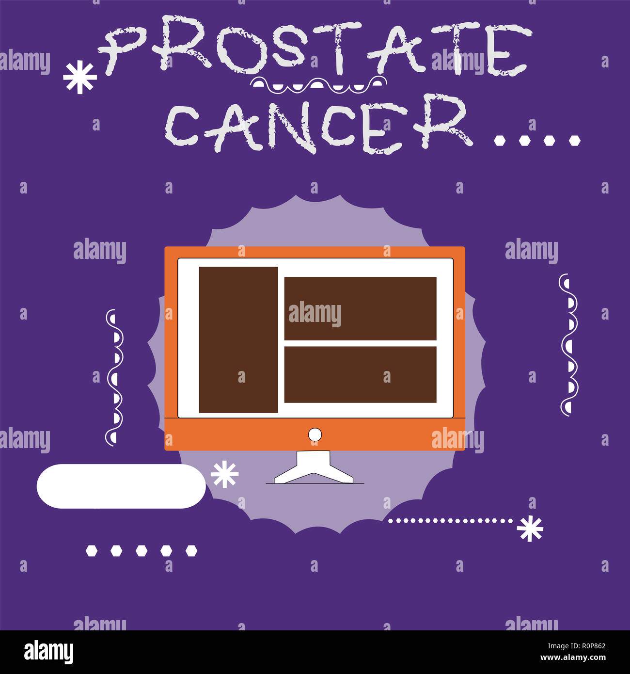 Writing note showing Prostate Cancer. Business photo showcasing Cancer ...