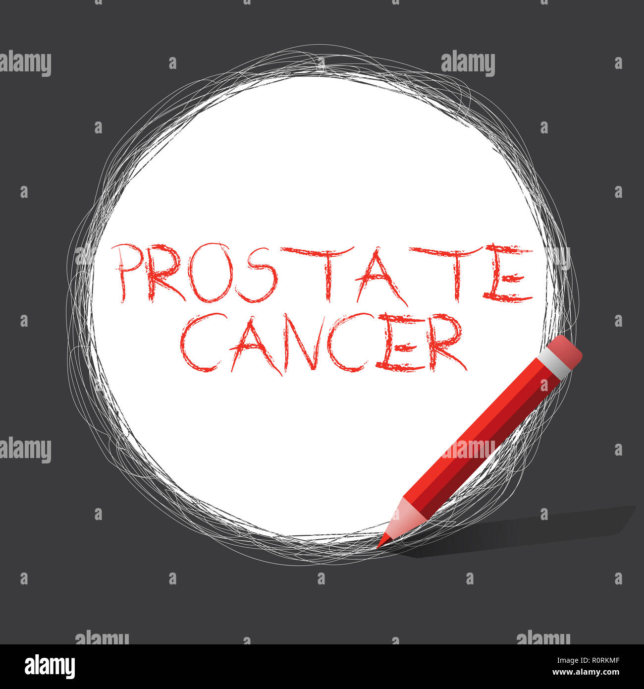 Writing note showing Prostate Cancer. Business photo showcasing Cancer ...