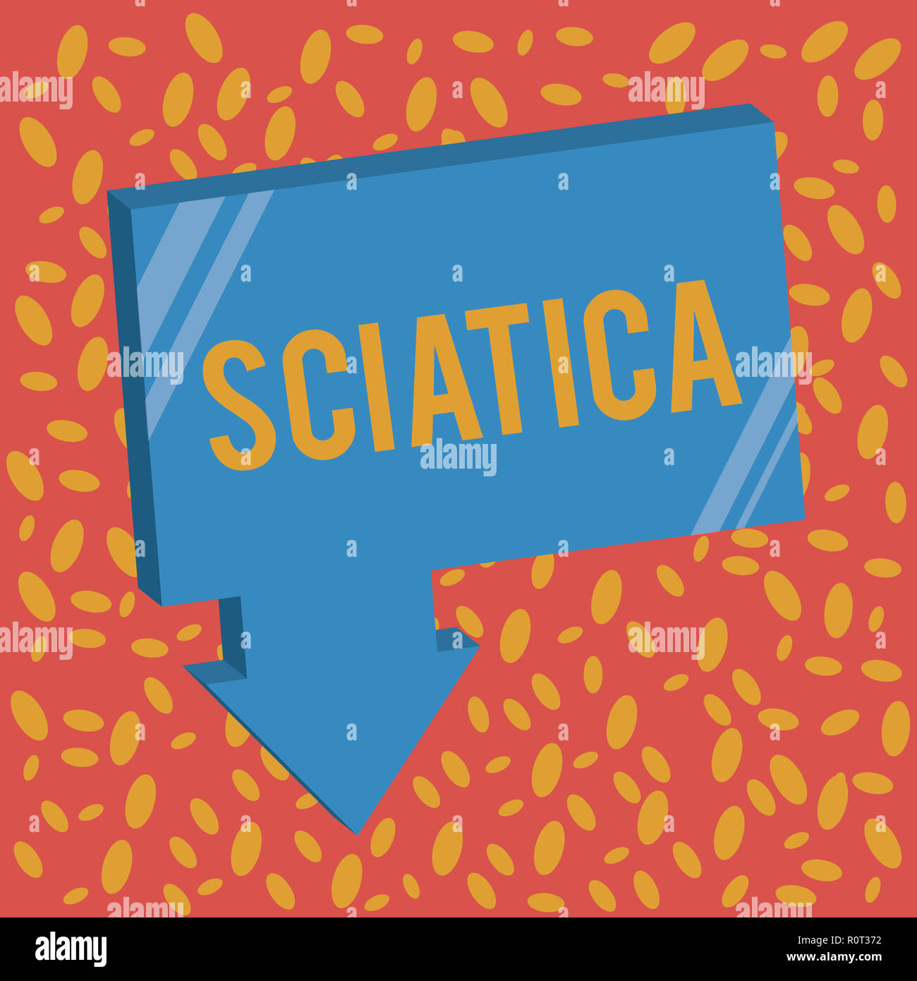 Writing note showing Sciatica. Business photo showcasing Pain caused by ...