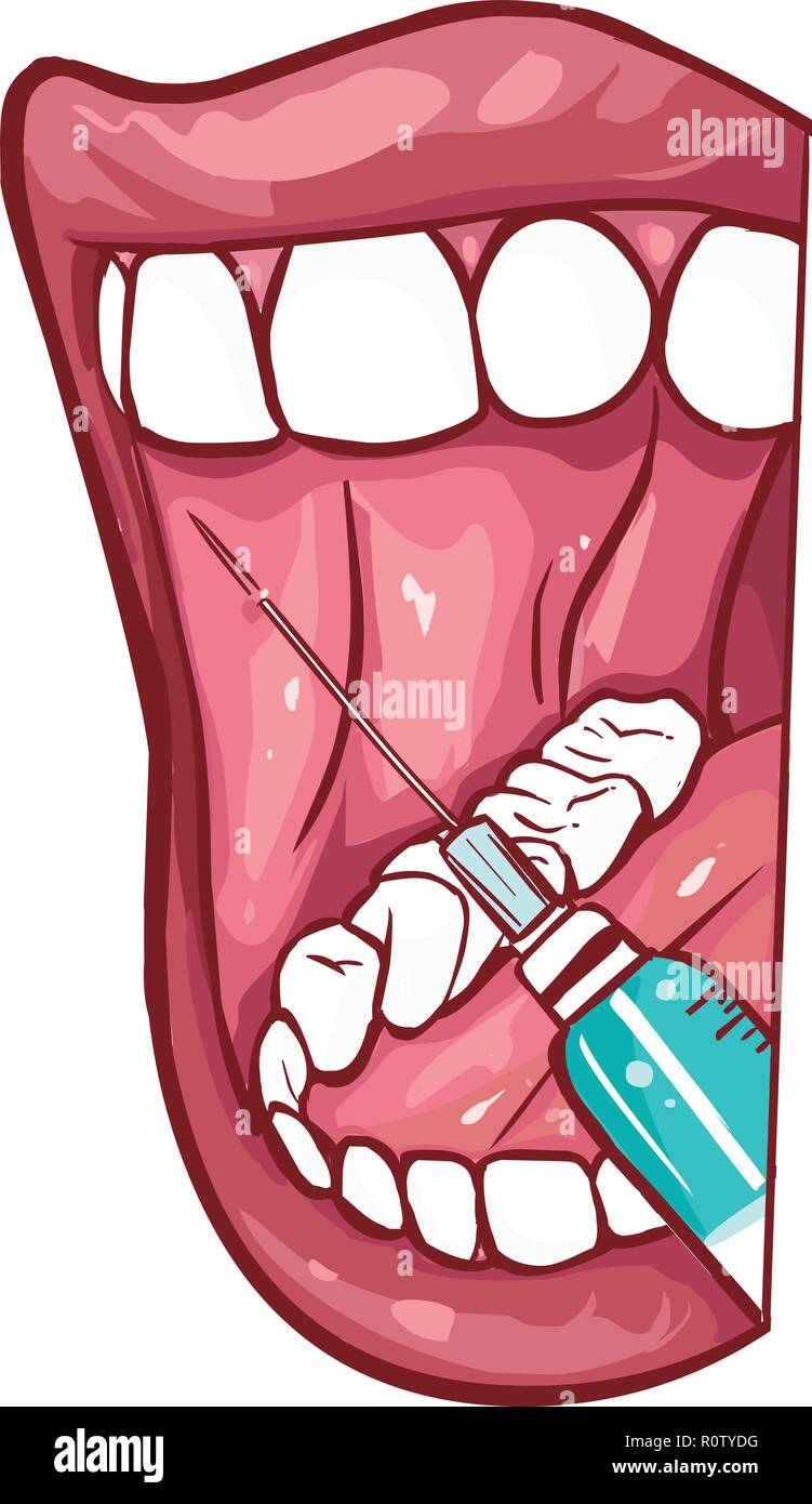 Maxillofacial surgery Stock Vector Images - Alamy