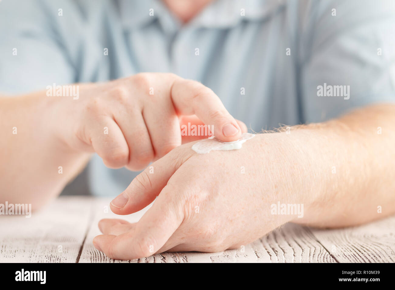 Man applying moisturizer cream on hands, dry skin Stock Photo - Alamy