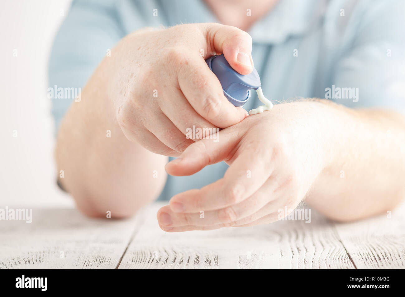 Man applying moisturizer cream on hands, dry skin. Dermatology, cold ...