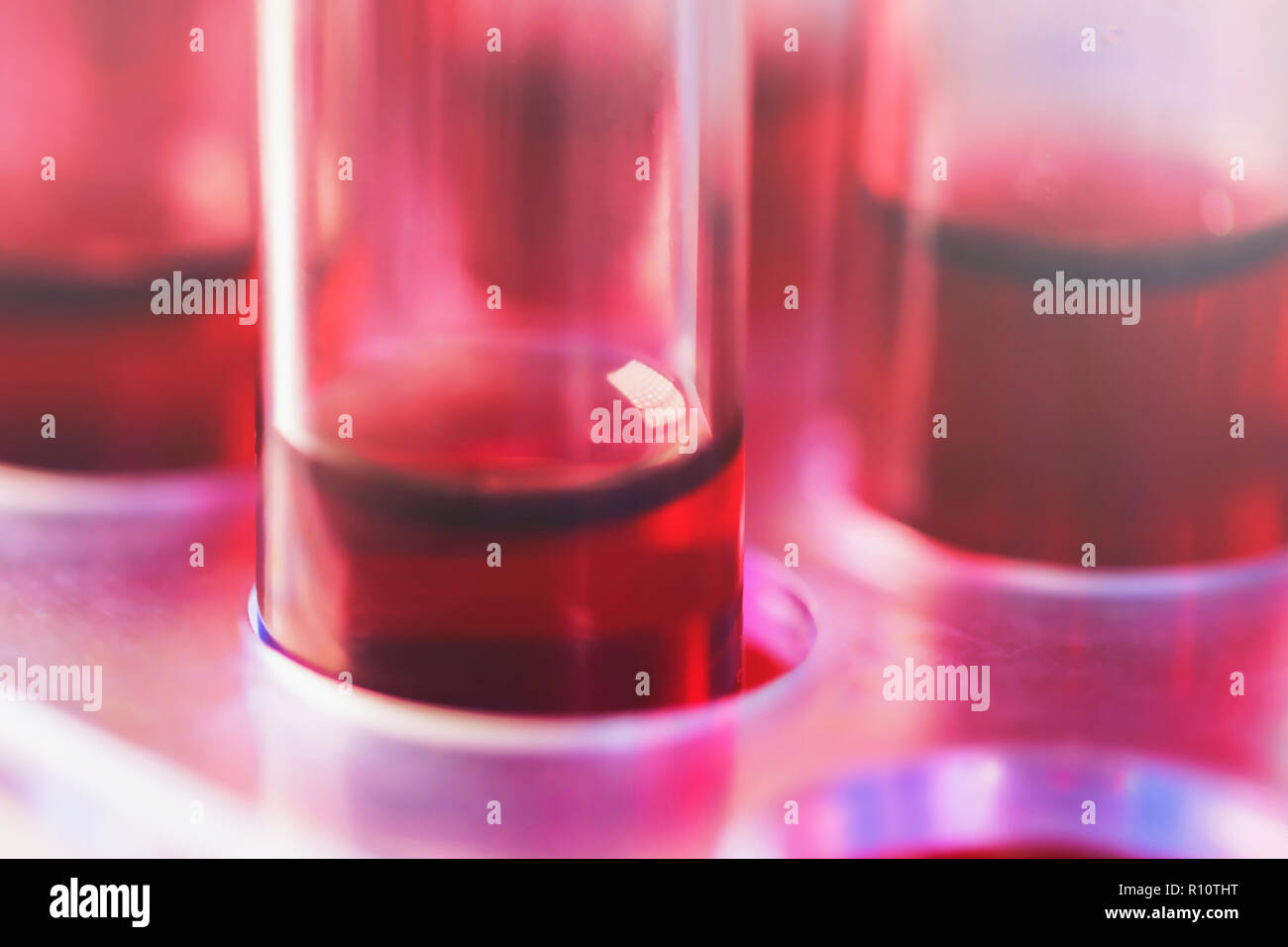 Test tubes Close up arranged in medical laboratory. Medical healthcare ...