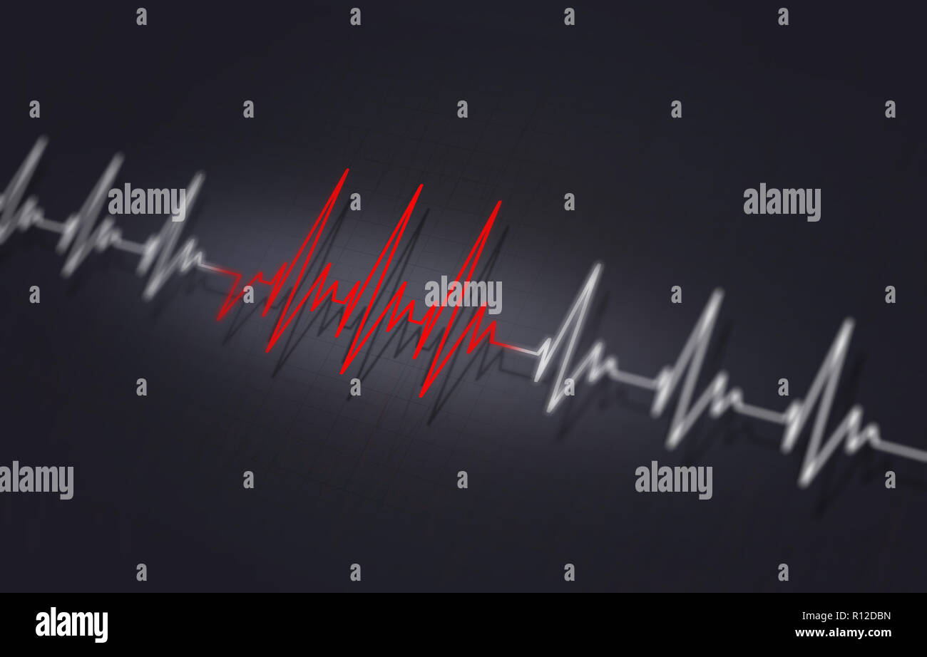 Rapid heart rate hi-res stock photography and images - Alamy