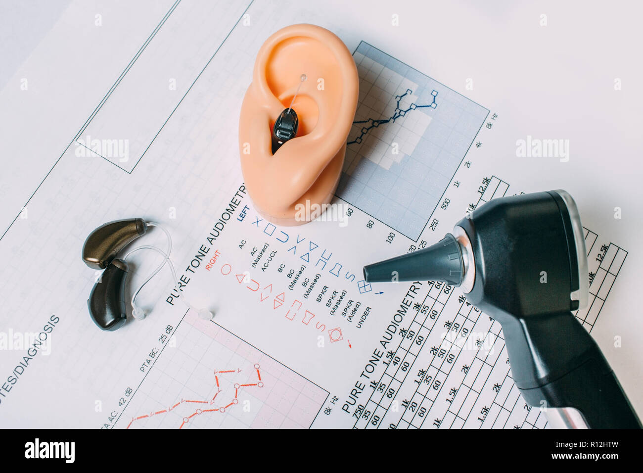 Hearing exam result - audiogram and hearing aids on the table Stock ...