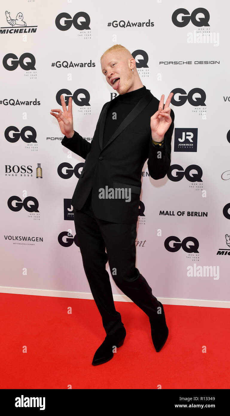 Albino-Model Shaun Ross