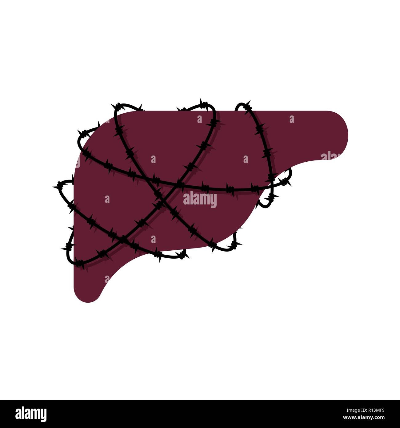Liver and barbed wire. Sick Internal organs Human anatomy. Metaphor of ...