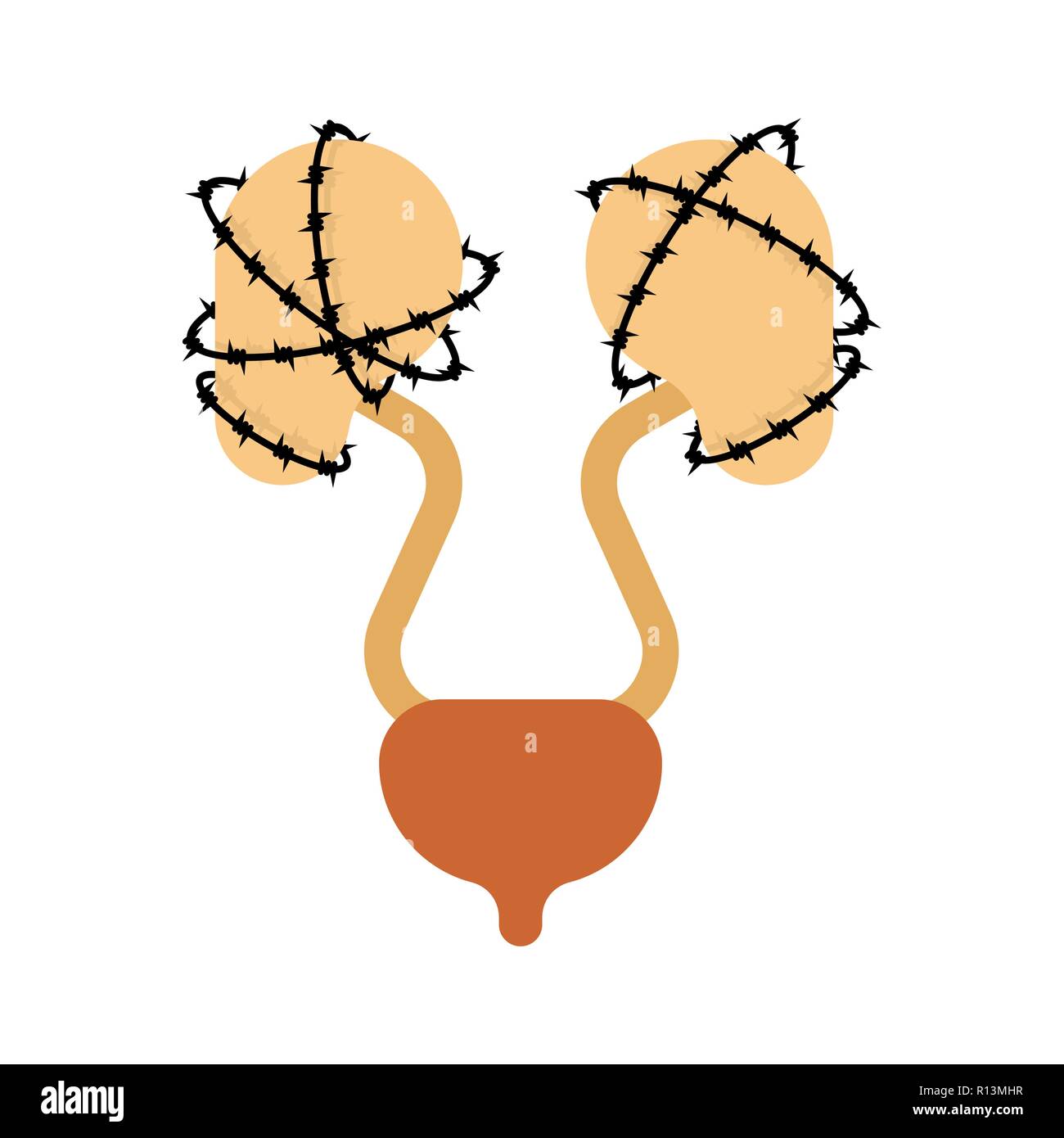 Kidney and barbed wire. Sick Internal organs Human anatomy. Metaphor of ...