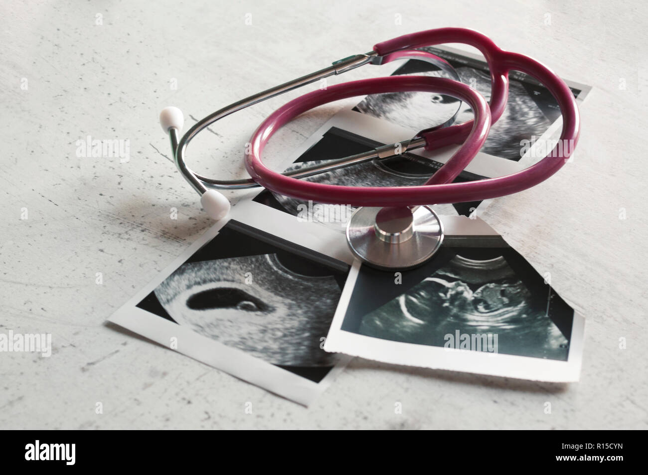 In the pictures of the ultrasound 4 weeks of pregnancy and 20 weeks is ...