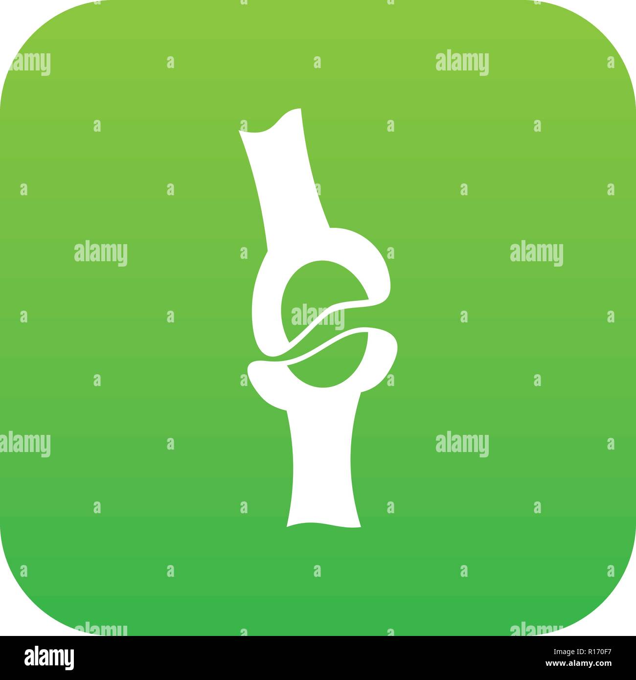 Knee replacement xray Stock Vector Images - Alamy