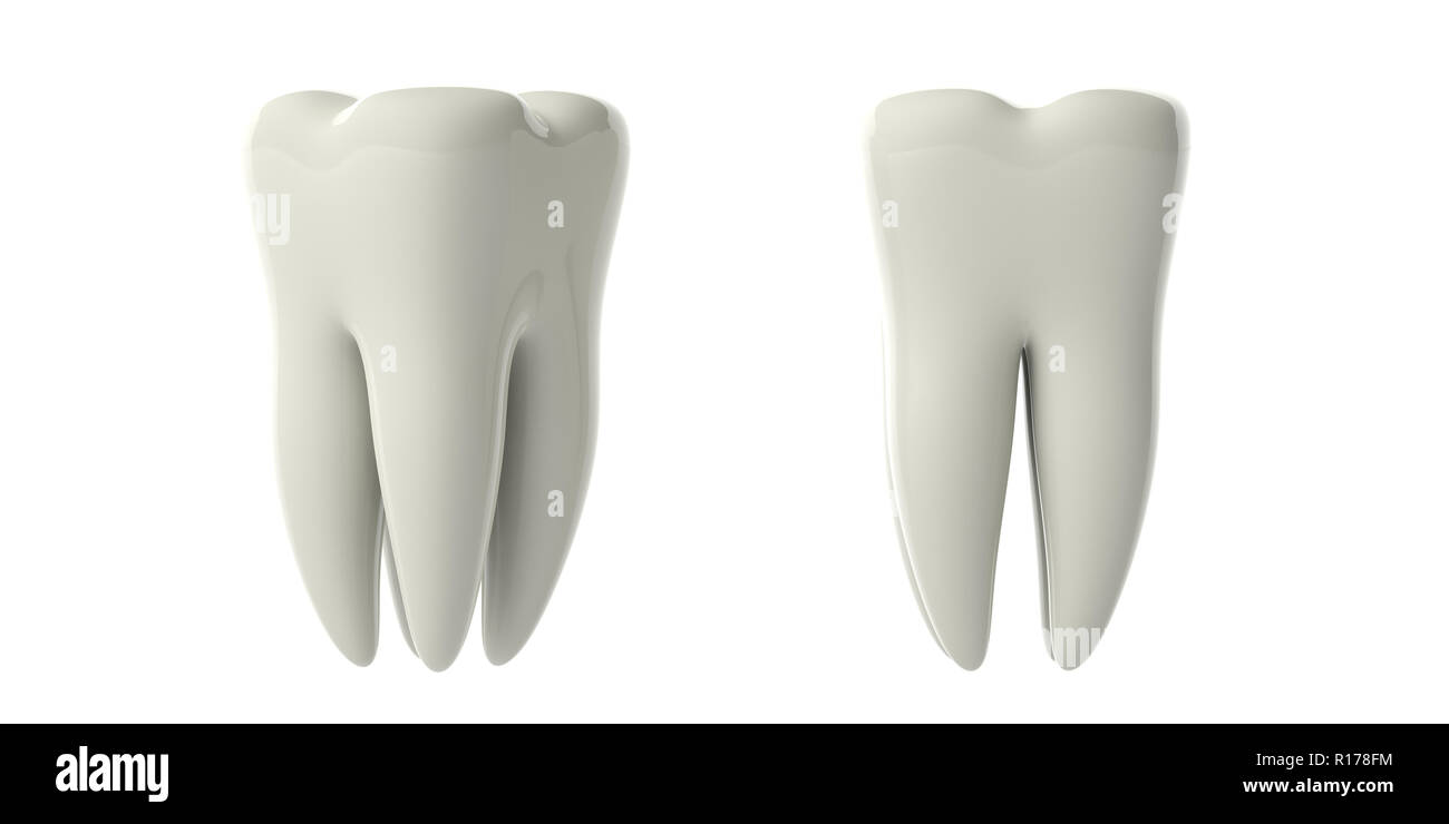 Teeth before whitening.Yellow dirty tooth models isolated cutout on ...