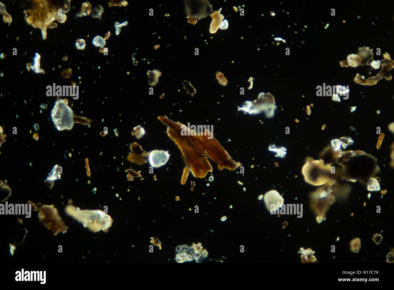 House dust, light micrograph Stock Photo - Alamy