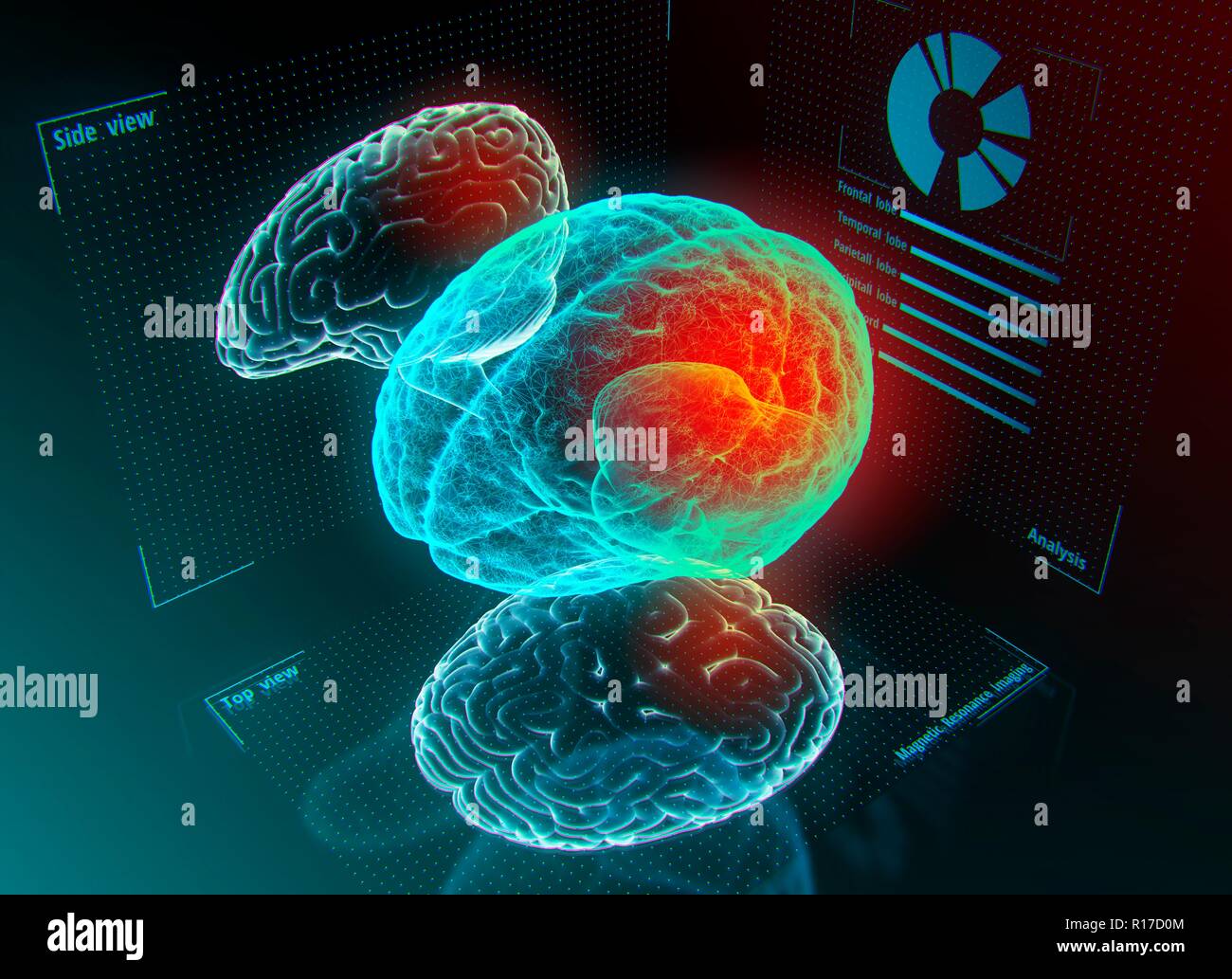 Brain research or diagnostic on the digital model in virtual reality ...