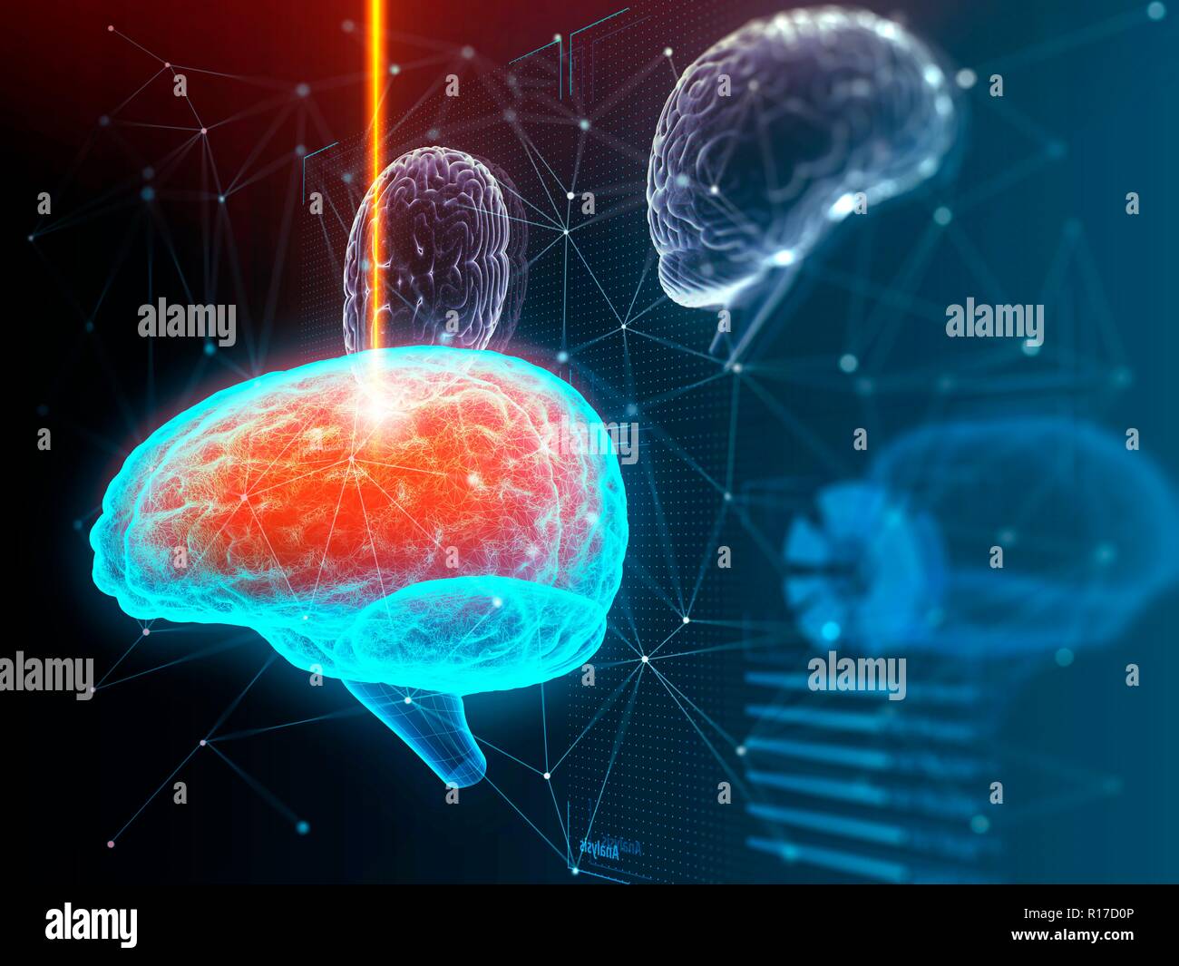 Laser surgery technology. Digital human brain in virtual space. 3d ...