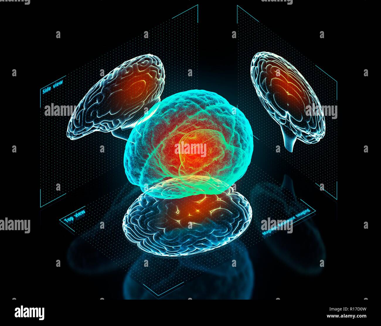 Pain Center Brain High Resolution Stock Photography and Images - Alamy