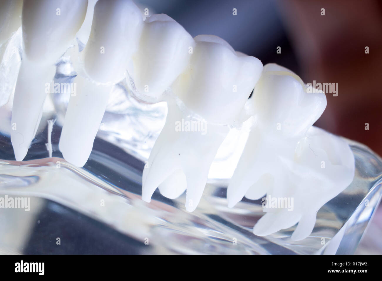 Dentist dental teeth teaching model showing each tooth and gum for ...