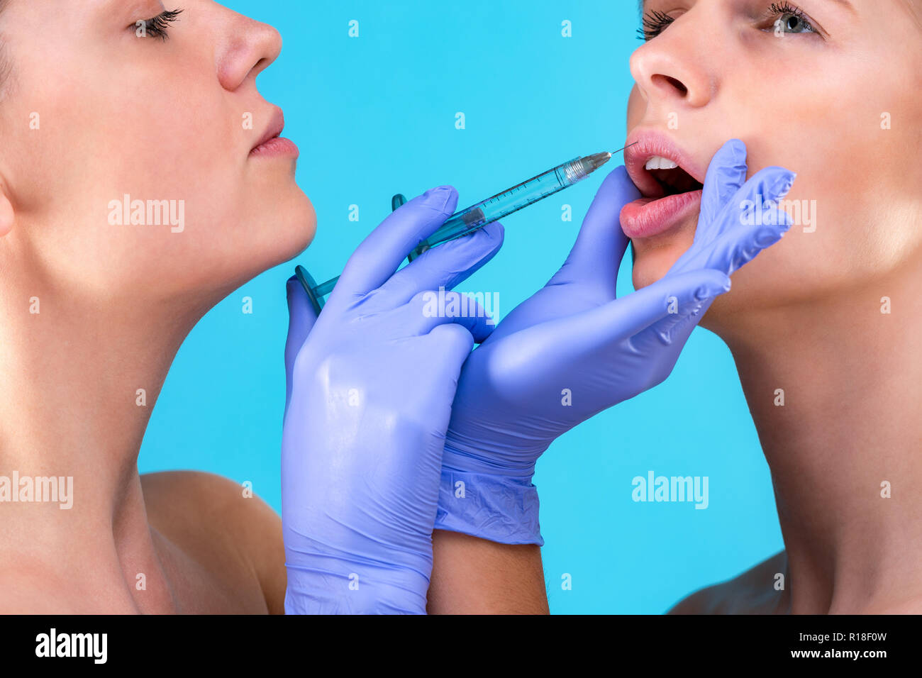 Beautiful women blonde and brunette make lip injections with syringe to ...